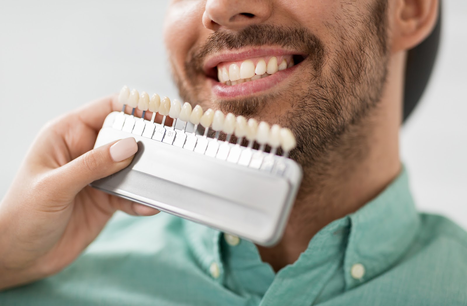 What Are Veneers & Will They Work for Me? | Shawnessy Dental
