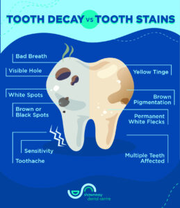 Cavity vs. Stain: How to Tell the Difference