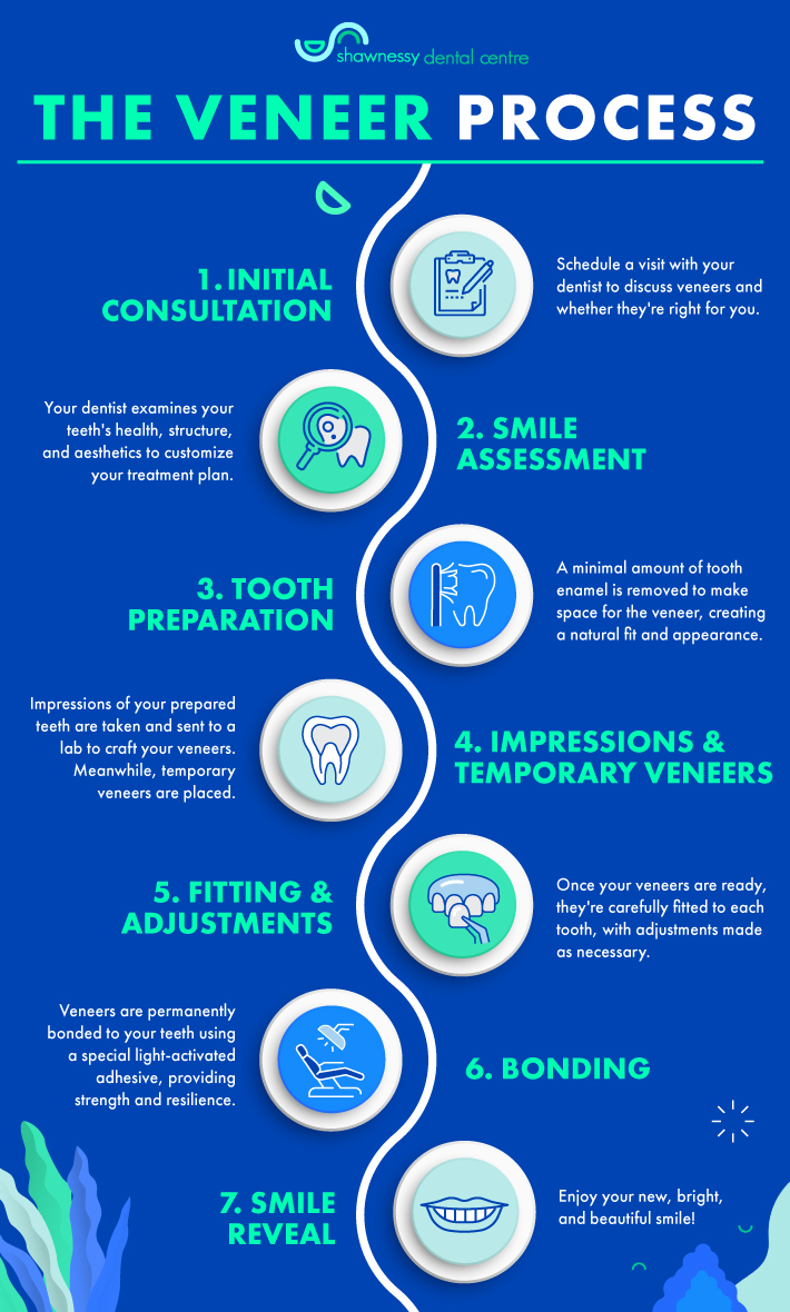Are Veneers Permanent? | Shawnessy Dental Centre | Calgary